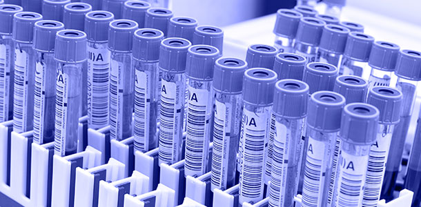 Automated Labels & Lab Automation - Tube & Vial Labeling - LabTAG